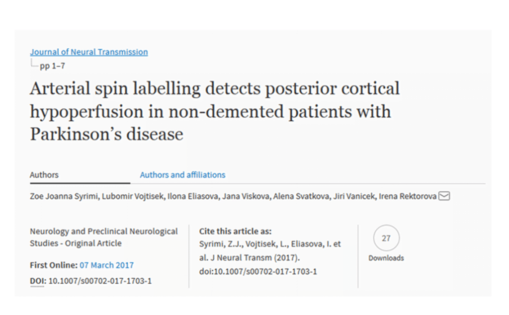 Arterial spin labelling detects posterior cortical hypoperfusion in non ...